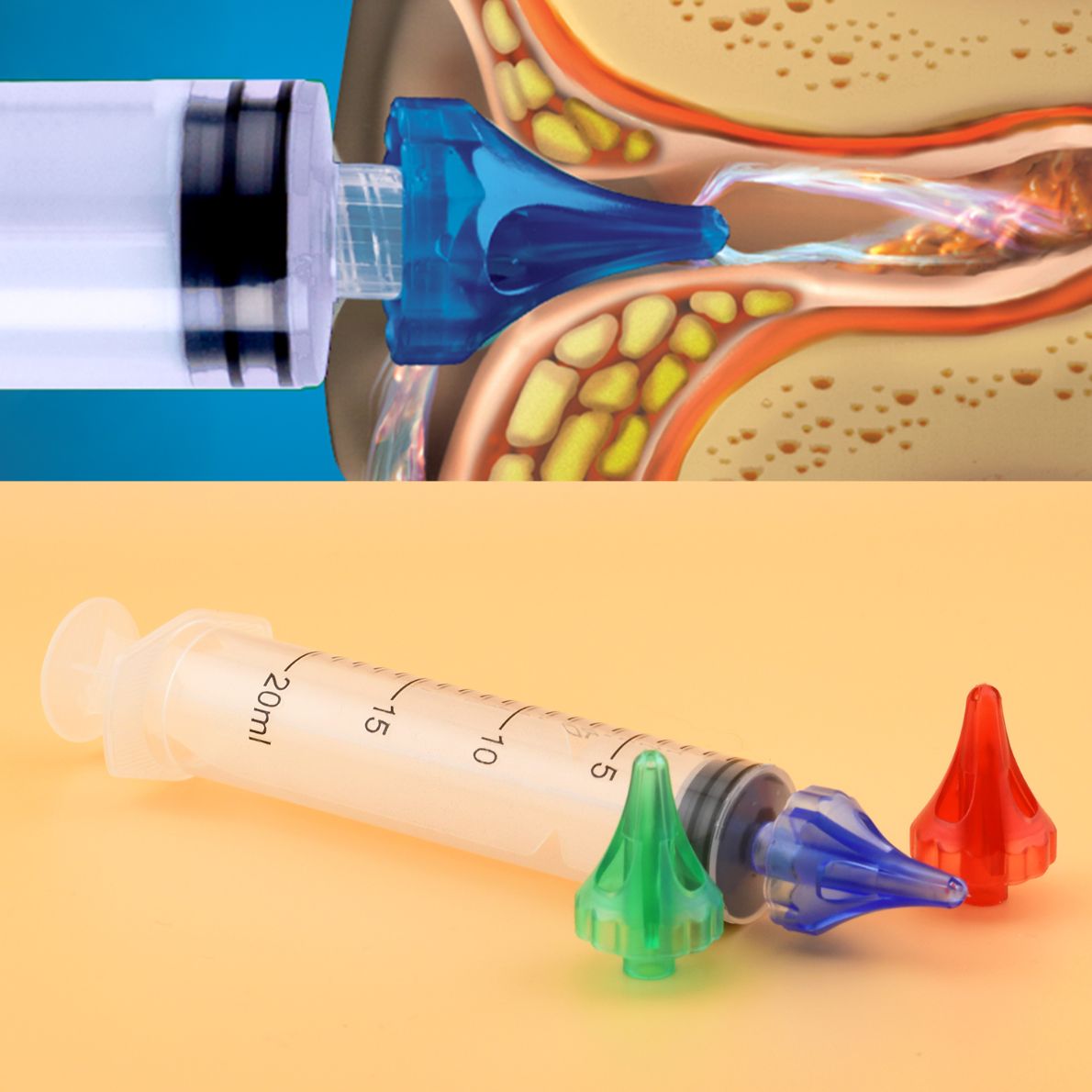 Ear Wax Syringe